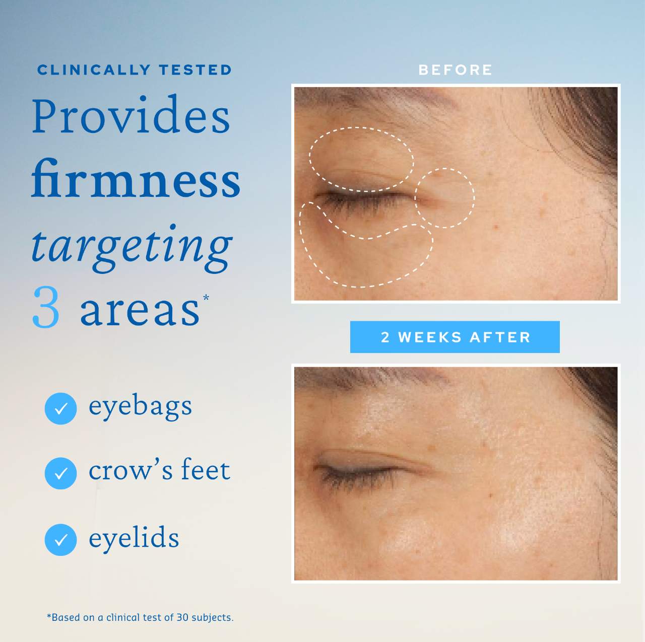 Moisturizing Eye Bomb With Peptide And Ceramide | Prevention Shop